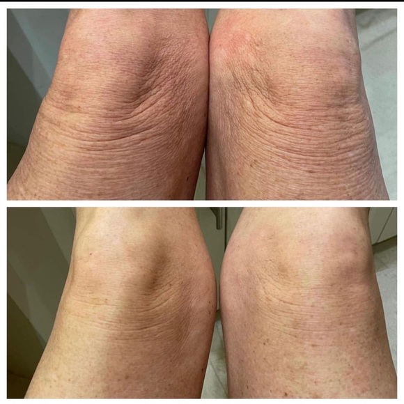 nuskin | Skincare | 2 Tubes Nuskin Ageloc Dermatic Effects Firming ...